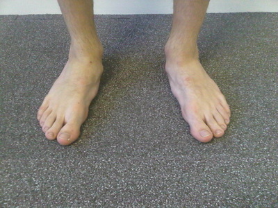 Knee Pain - GOLD COAST | Affordable Fast Pain Relief | Podiatry & Physio